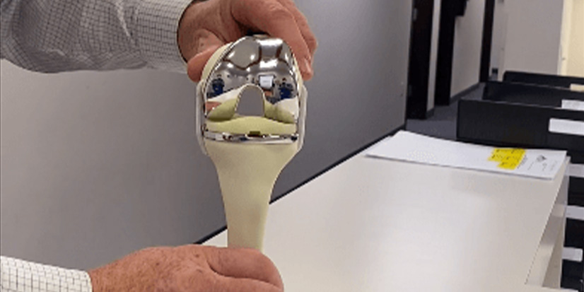 Everything You Need to Know About Total Joint Replacements